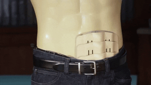 StomaGear - StomaShield Stoma Guard | StomaShield: Stoma Guard, Ostomy ...