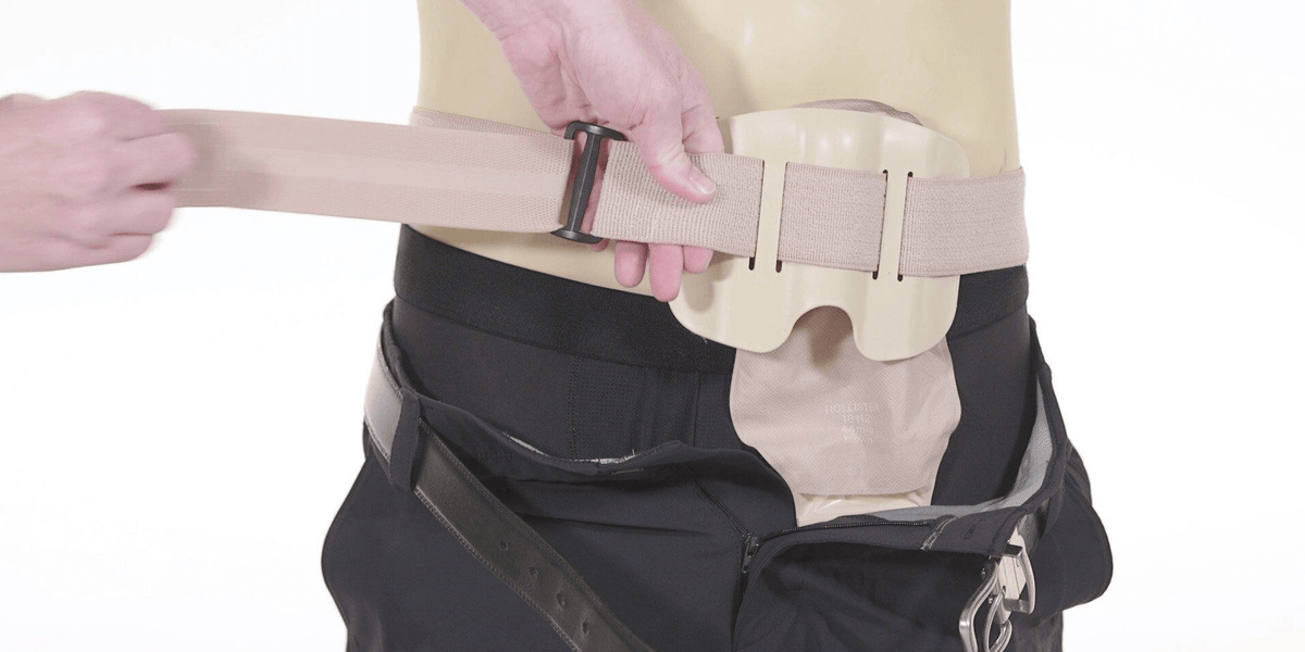 StomaShield: Stoma Guard | The Adjustable Stoma Guard | StomaGear ...