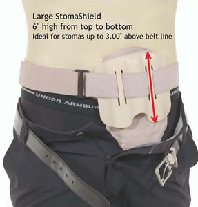 StomaGear - StomaShield Stoma Guard | StomaShield: Custom Fit Stoma ...