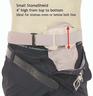 StomaGear - StomaShield Stoma Guard | StomaShield: Stoma Guard, Ostomy ...